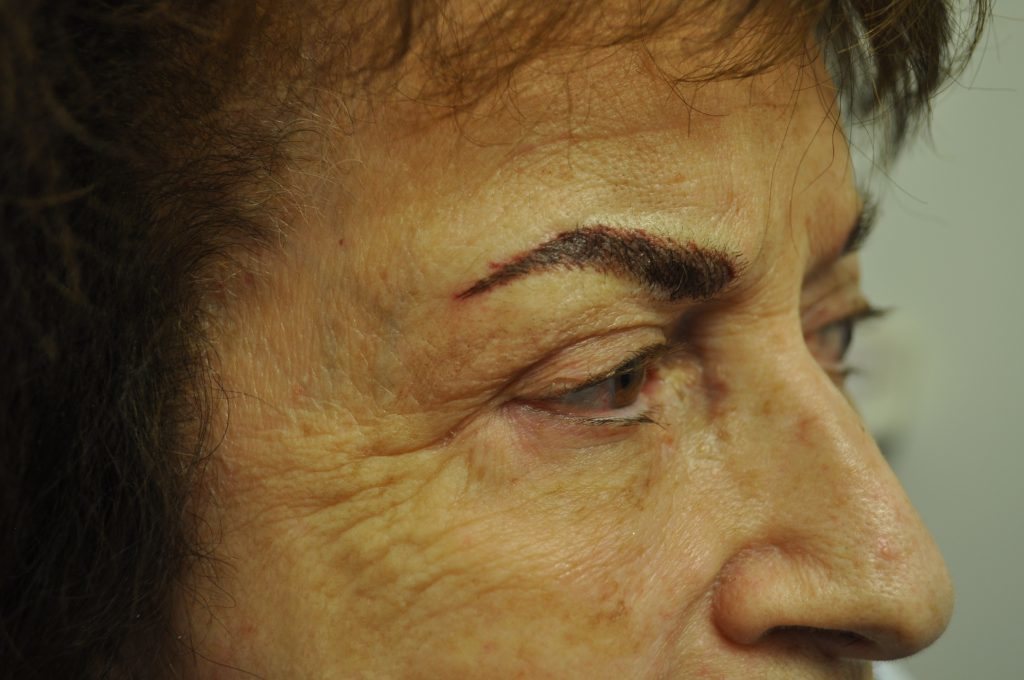 NYC Permanent Cosmetic Makeup and Medical Tattooing